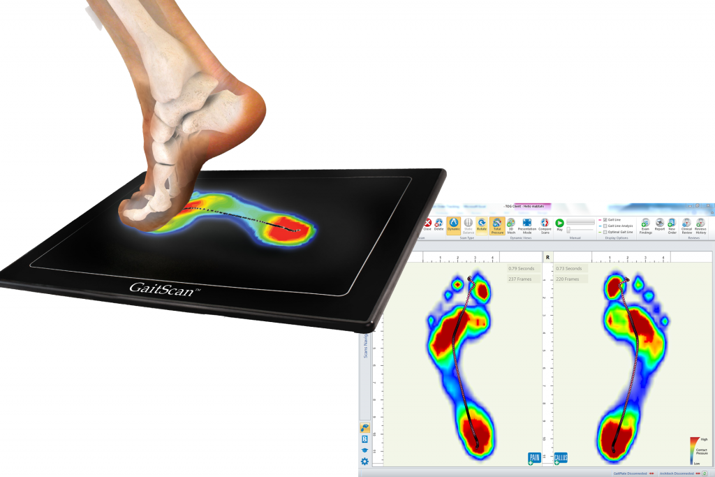 The Technology - Footmedic